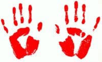 Red palms and the liver – what do they tell us? - Dr Sandra Cabot MD