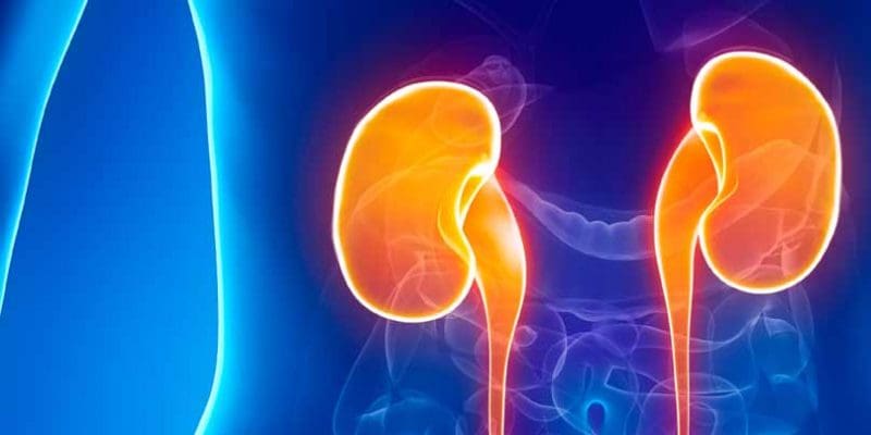 Kidney Damage - Dr Sandra Cabot MD