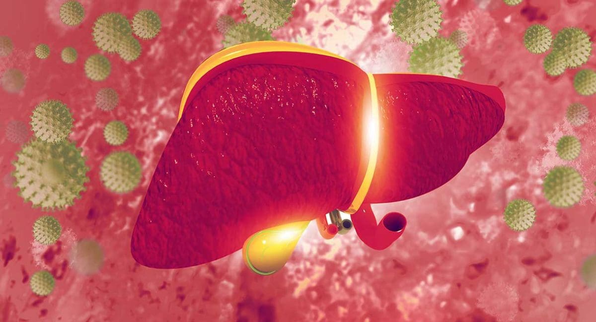 Primary Biliary Cholangitis (PBC) - Dr Sandra Cabot MD