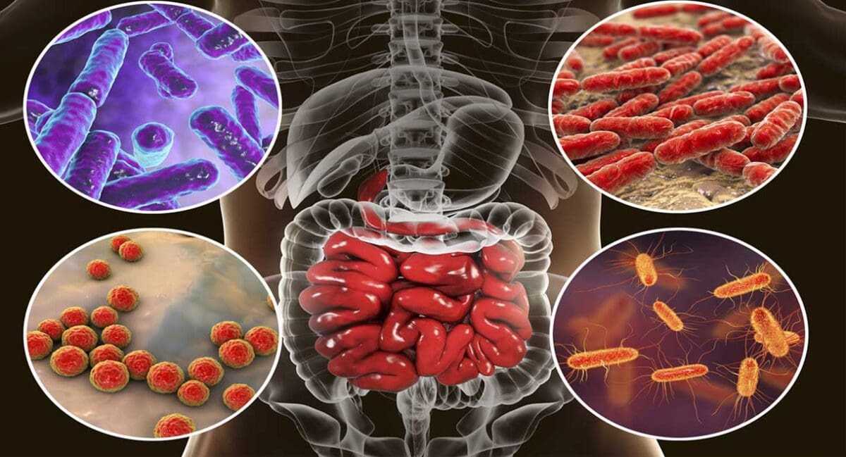 Your Gut Bugs And Your Weight - Dr Sandra Cabot MD