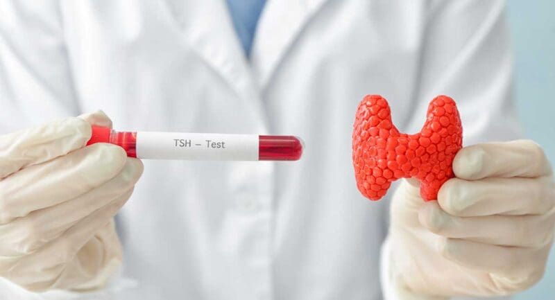 Thyroid Function Tests - Understanding Your Blood Test Results - Dr ...