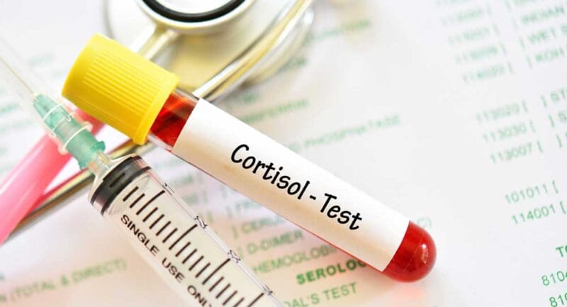 Adrenal Function Tests - Understanding Your Blood Test Results - Dr ...
